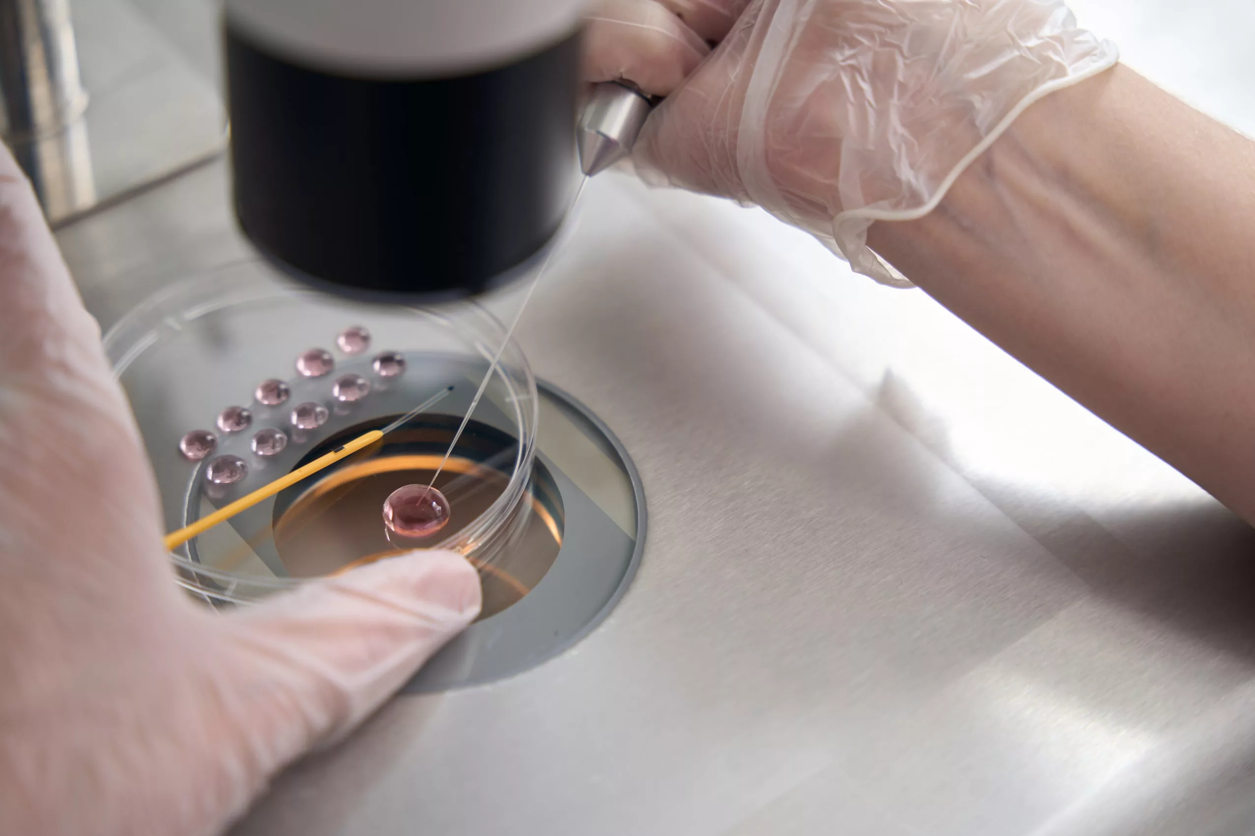 Vitrification à Tours | Technique d'AMP | Centre de Fertilité